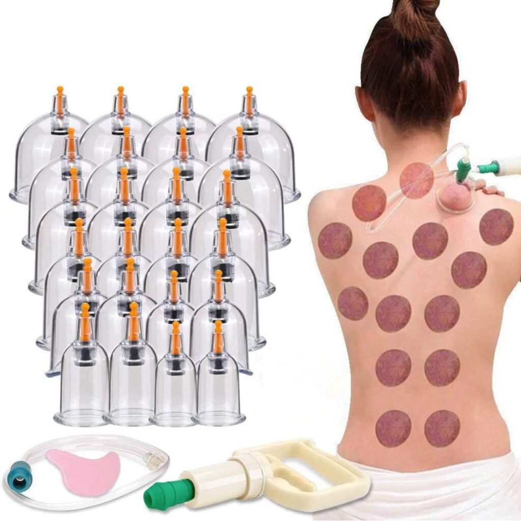 Estasis De Sangre: Un Concepto Clave En Acupuntura | SA Acupuntura