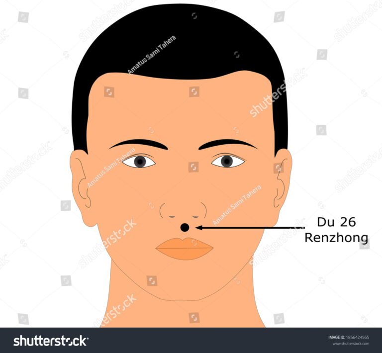 Renzhong: El Punto Vital De La Acupuntura | SA Acupuntura